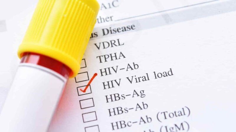 STD Testing in Florida: Have You Really Been Tested? - CWC